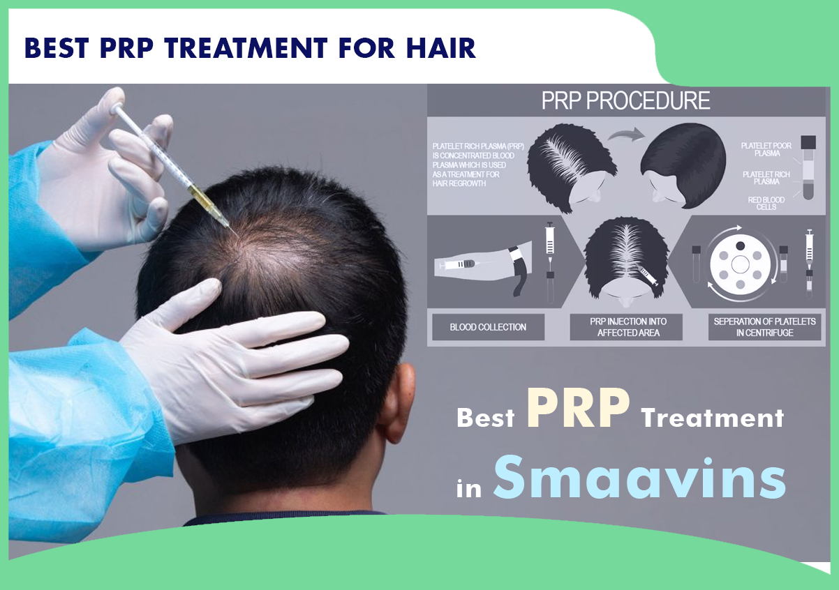 Best PRP Treatment For Hair | Smaavins, Chennai
