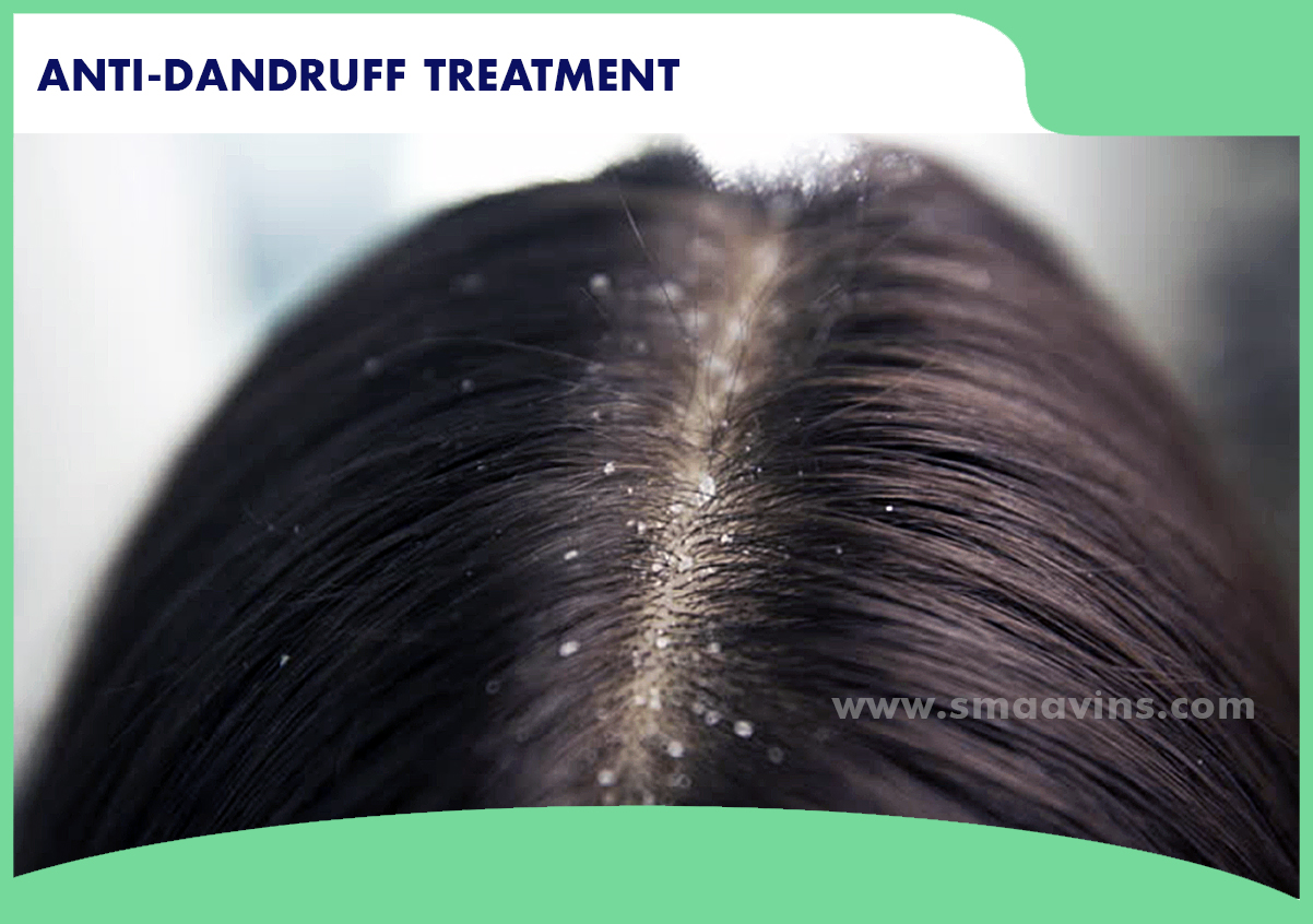 Get The Best Anti-dandruff Treatment In Chennai At Smaavins