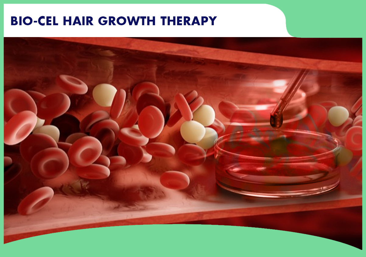 Best Bio-Cel Hair Growth Therapy | Chennai | Smaavins