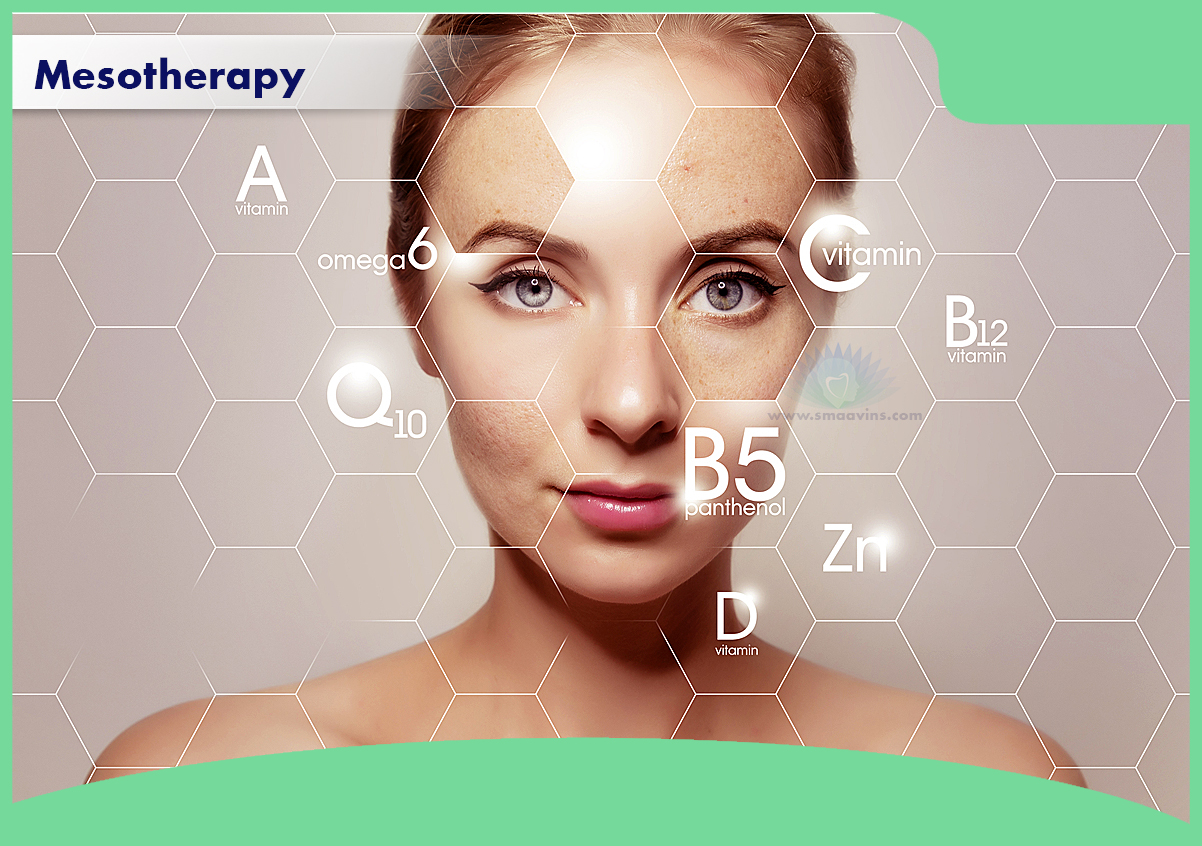 Get The Best Mesotherapy Treatment In Chennai | Smaavins